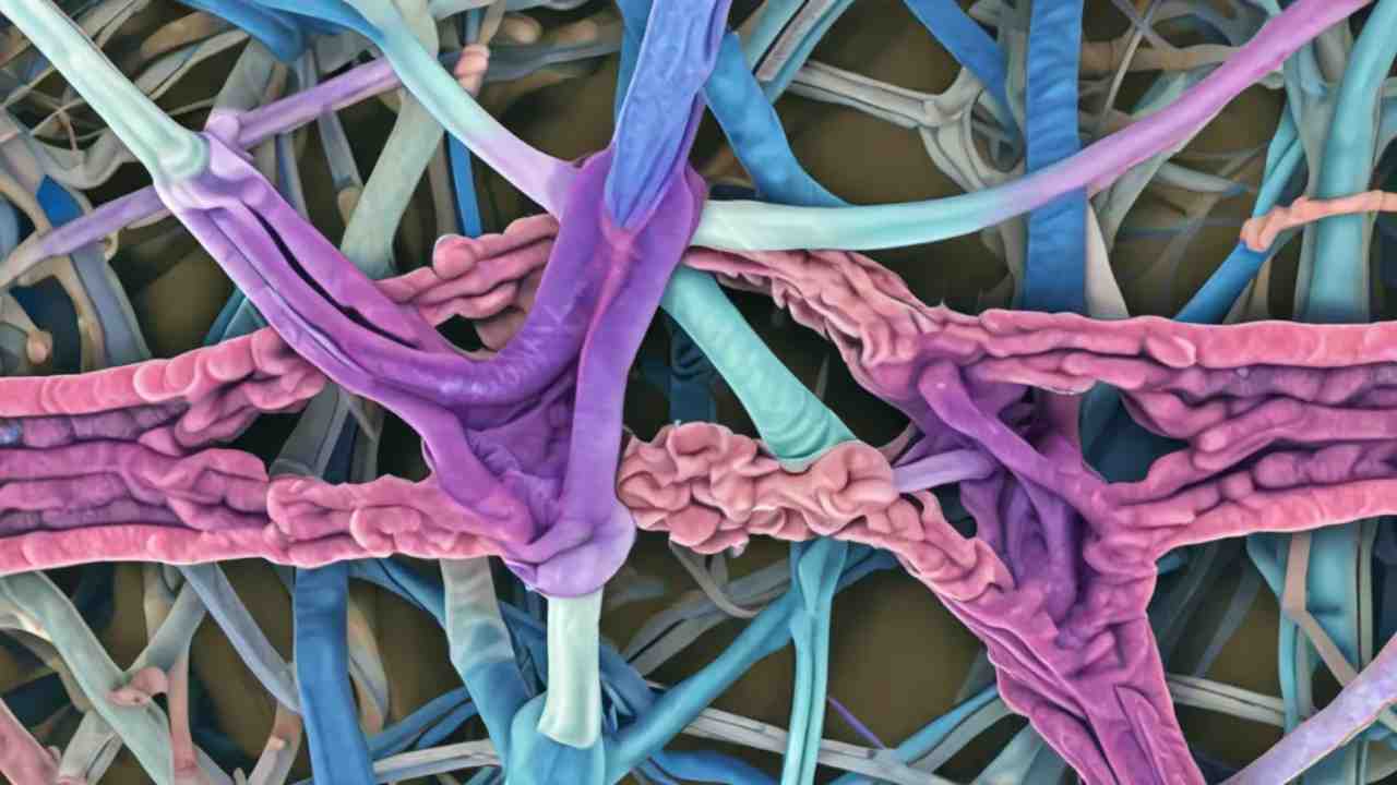 Prion Disease in Deer: Cause for Concern or Media Hype?